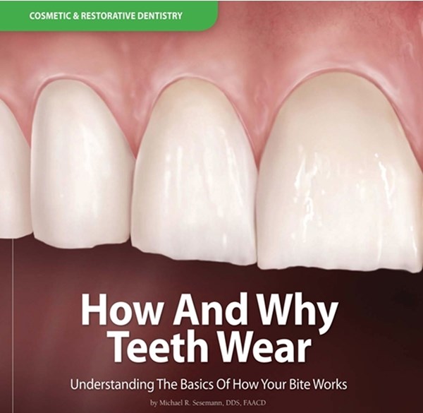 Tooth Wear | Restore & Protect Worn-Down Teeth