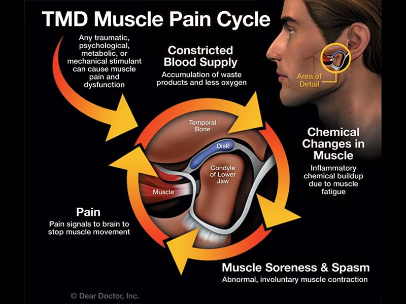 TMJ Treatment | Relief for Jaw Pain & Discomfort